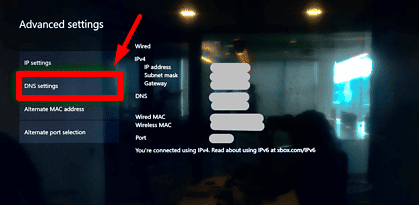 Xbox Download Speed Slow - Here's How To Improve It