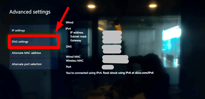 Xbox Download Speed Slow - Here's How To Improve It